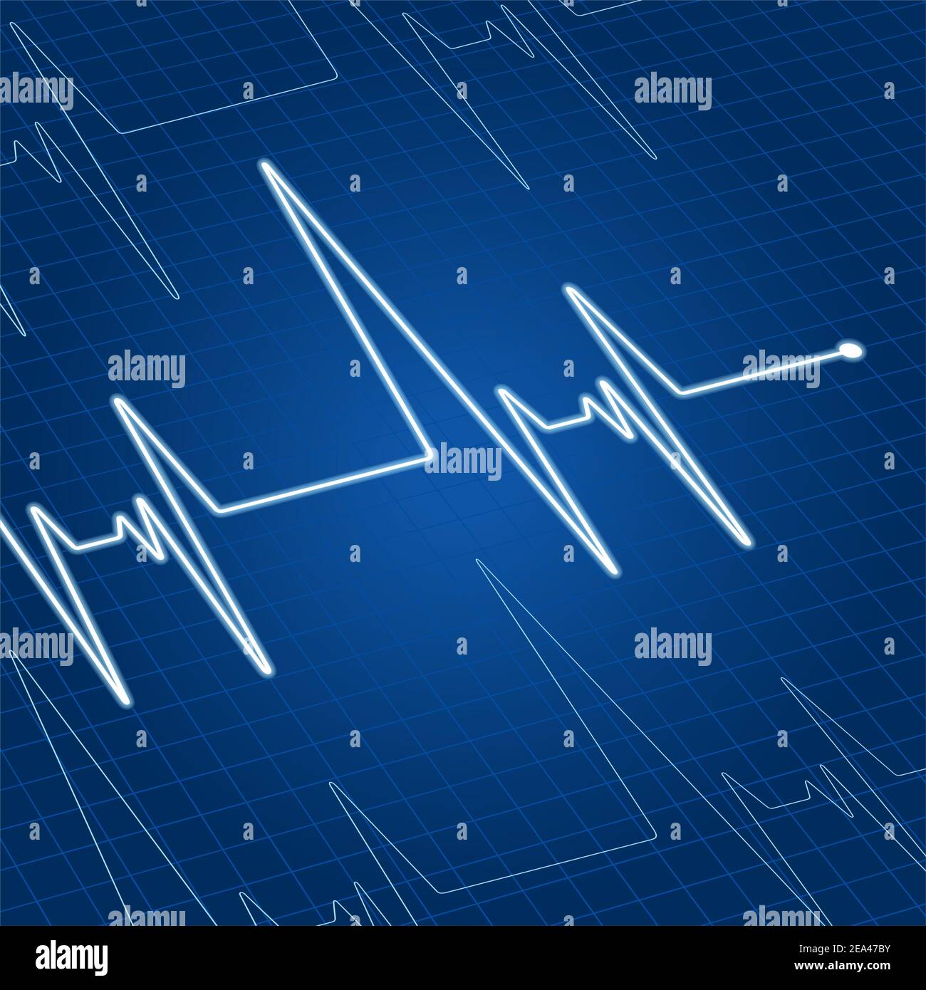 Heart pulse on blue screen for medicine and cardiology design Stock ...