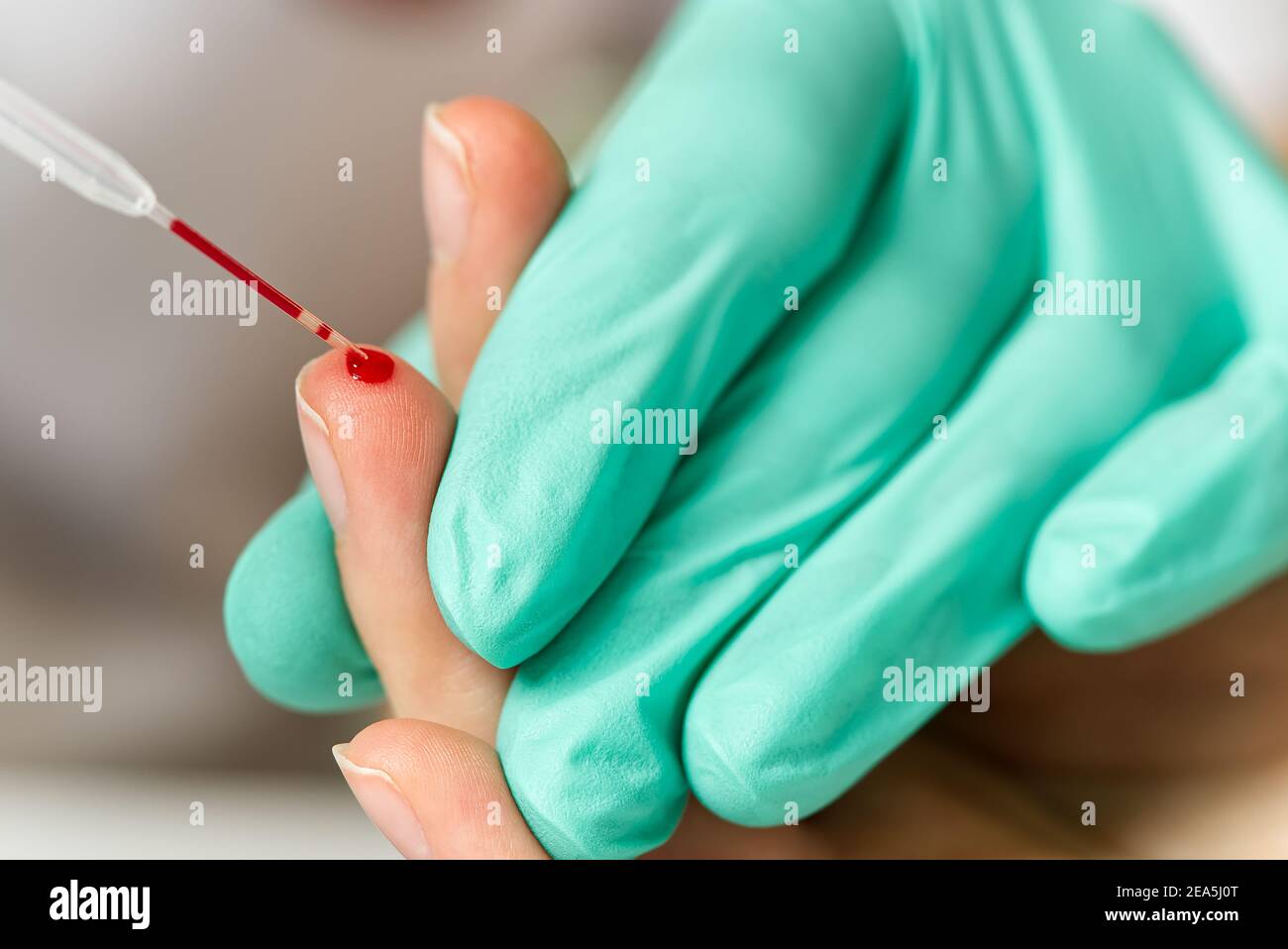 COVID-19 test and laboratory sample of blood testing for diagnosis new ...