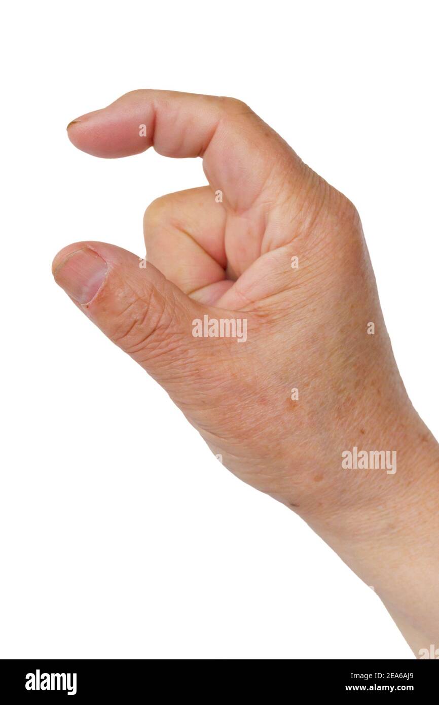Hand pinch skin hi-res stock photography and images - Alamy