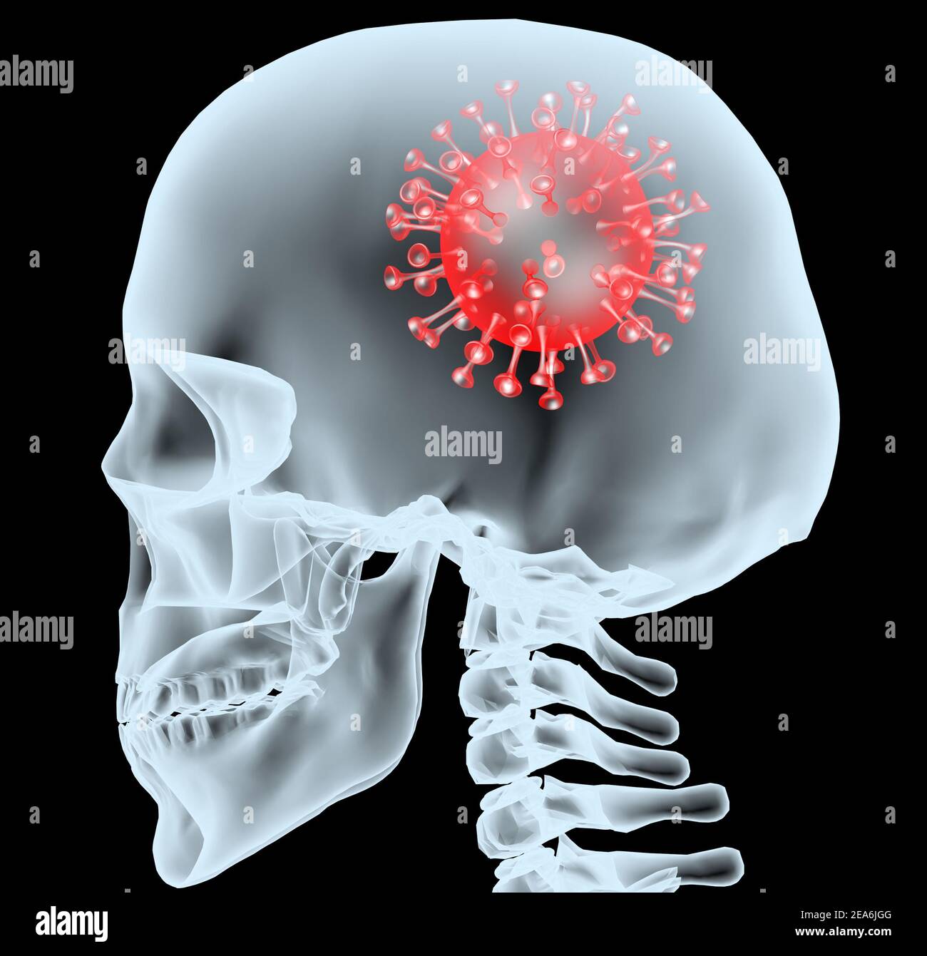 coronavirus disease COVID-19 virus infection in human brain, 3d ...