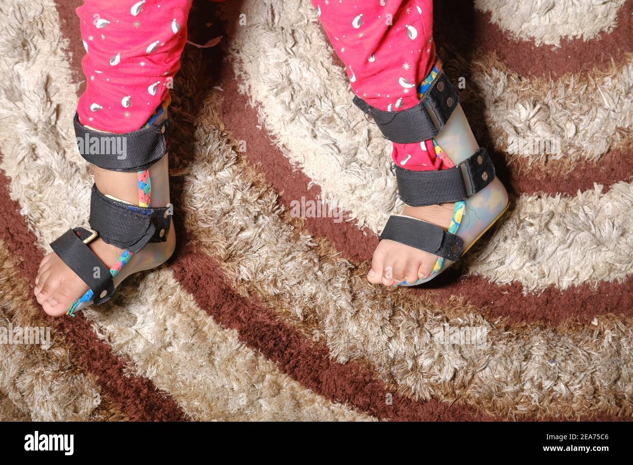 Child cerebral palsy disability, legs orthosis Stock Photo - Alamy