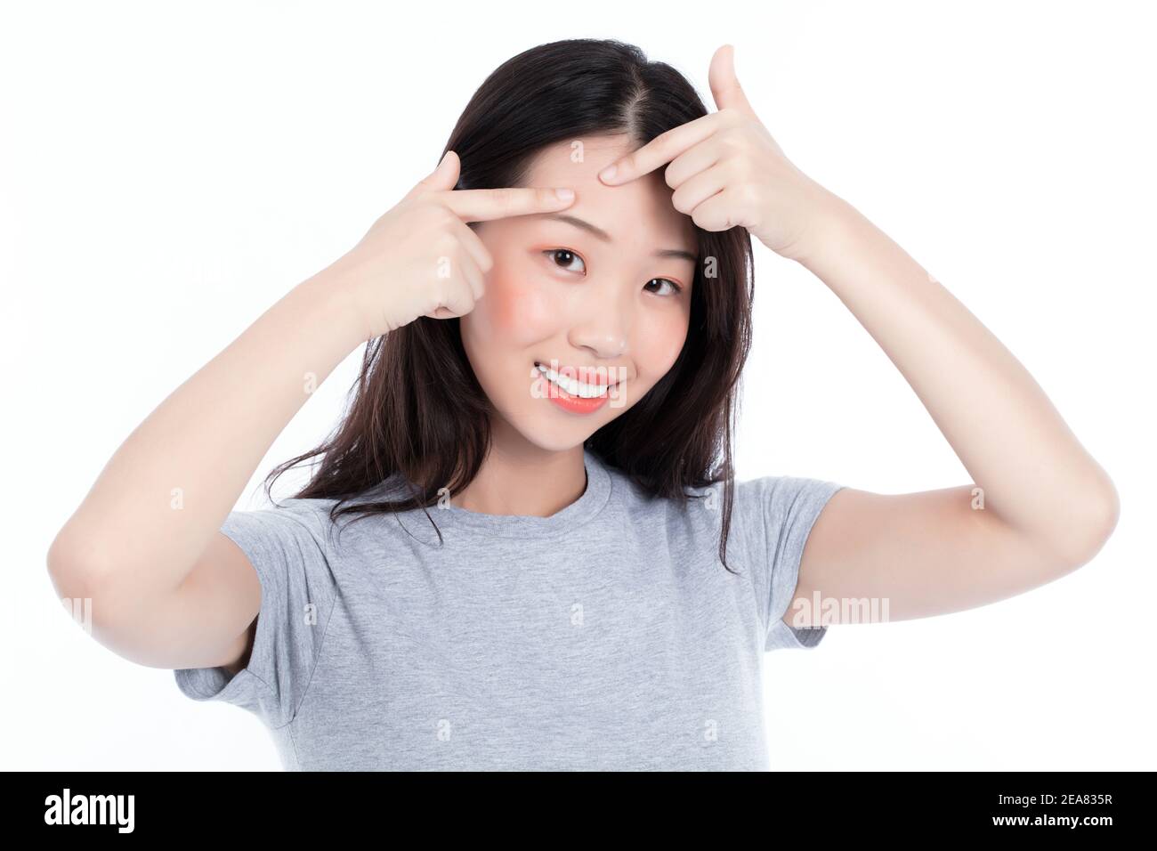 Acne On Forehead High Resolution Stock Photography and Images - Alamy