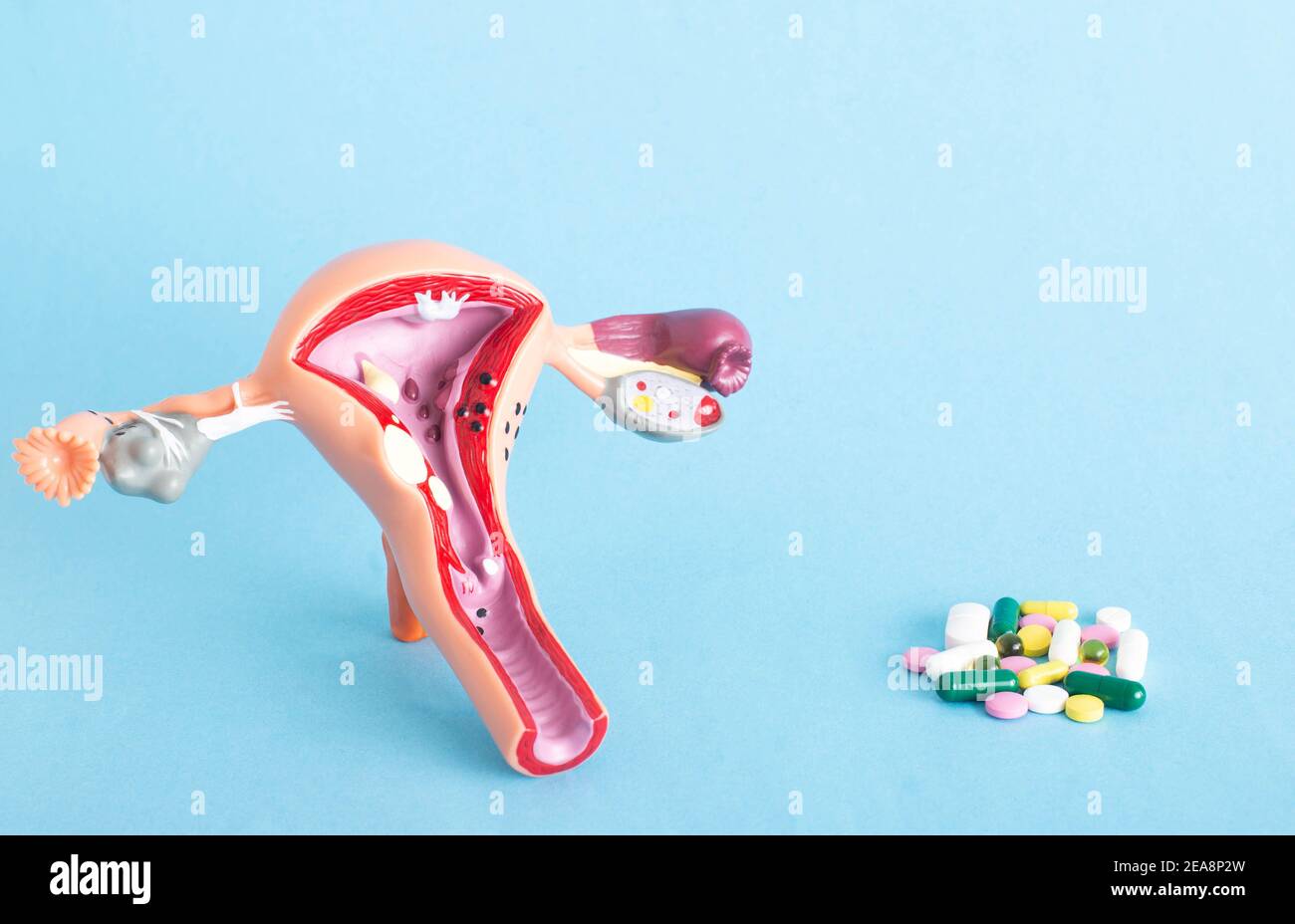 Genitourinary female hi-res stock photography and images - Alamy