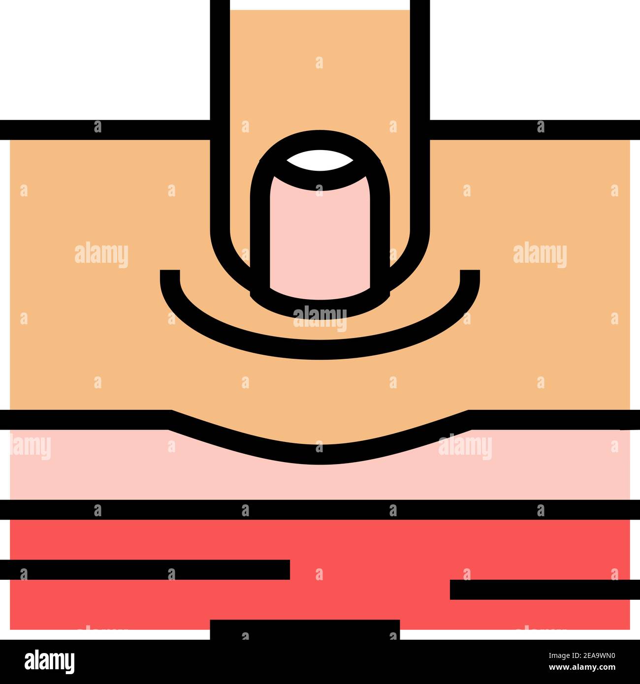 pitting edema on patient leg color icon vector illustration Stock ...
