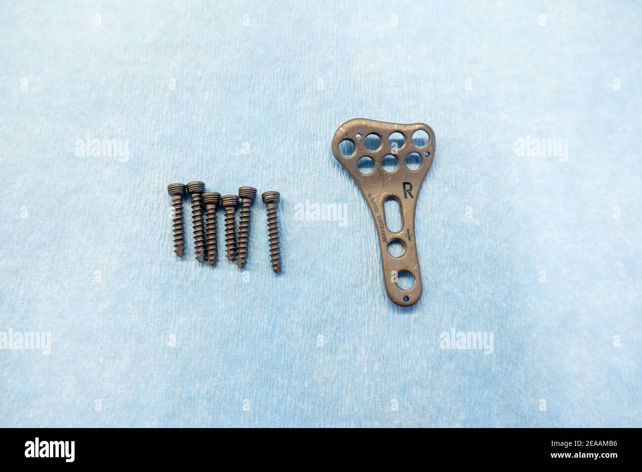 an explanted titanium plate and 4 titanium screws for the treatment of ...