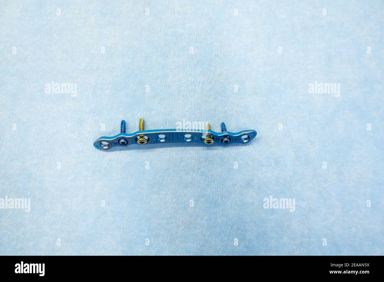 Clavicle fracture xray hi-res stock photography and images - Alamy
