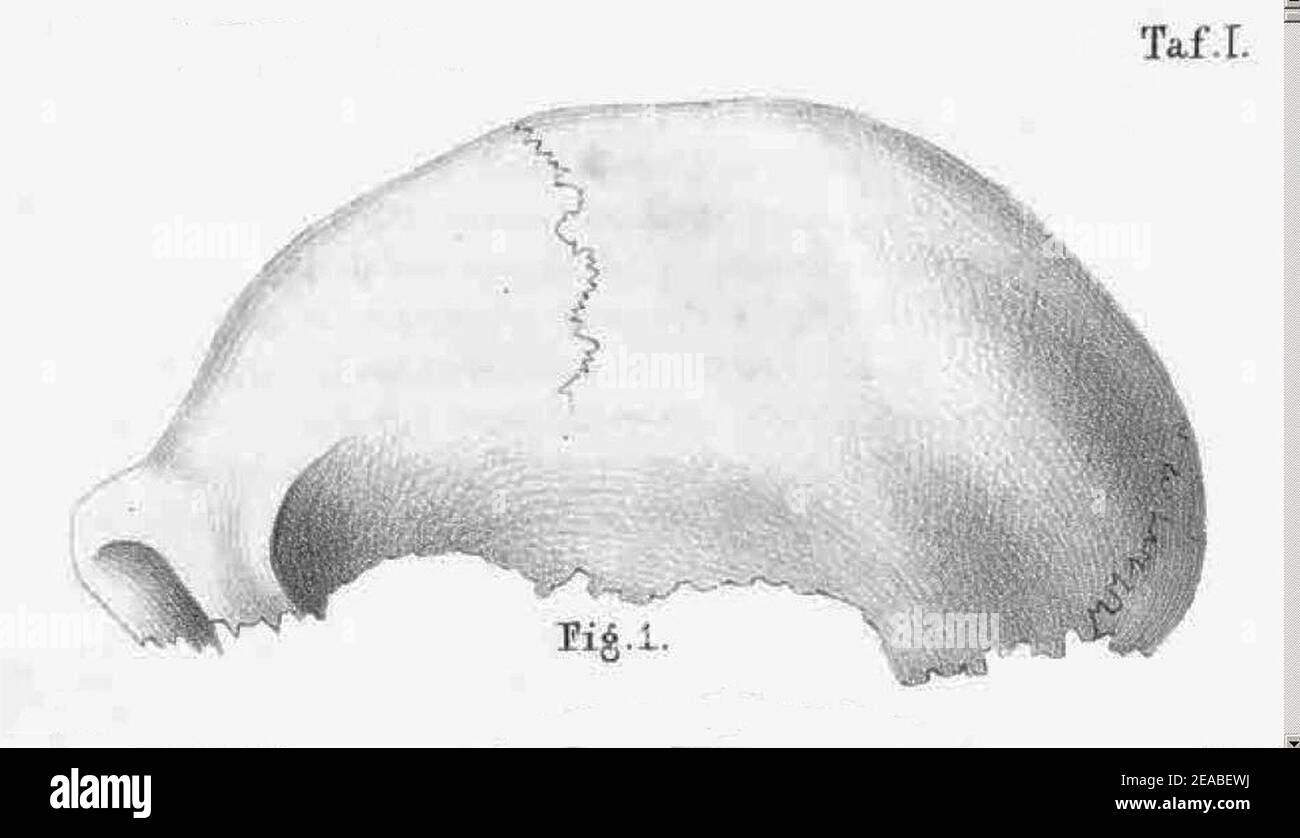 Calvarium hi-res stock photography and images - Alamy