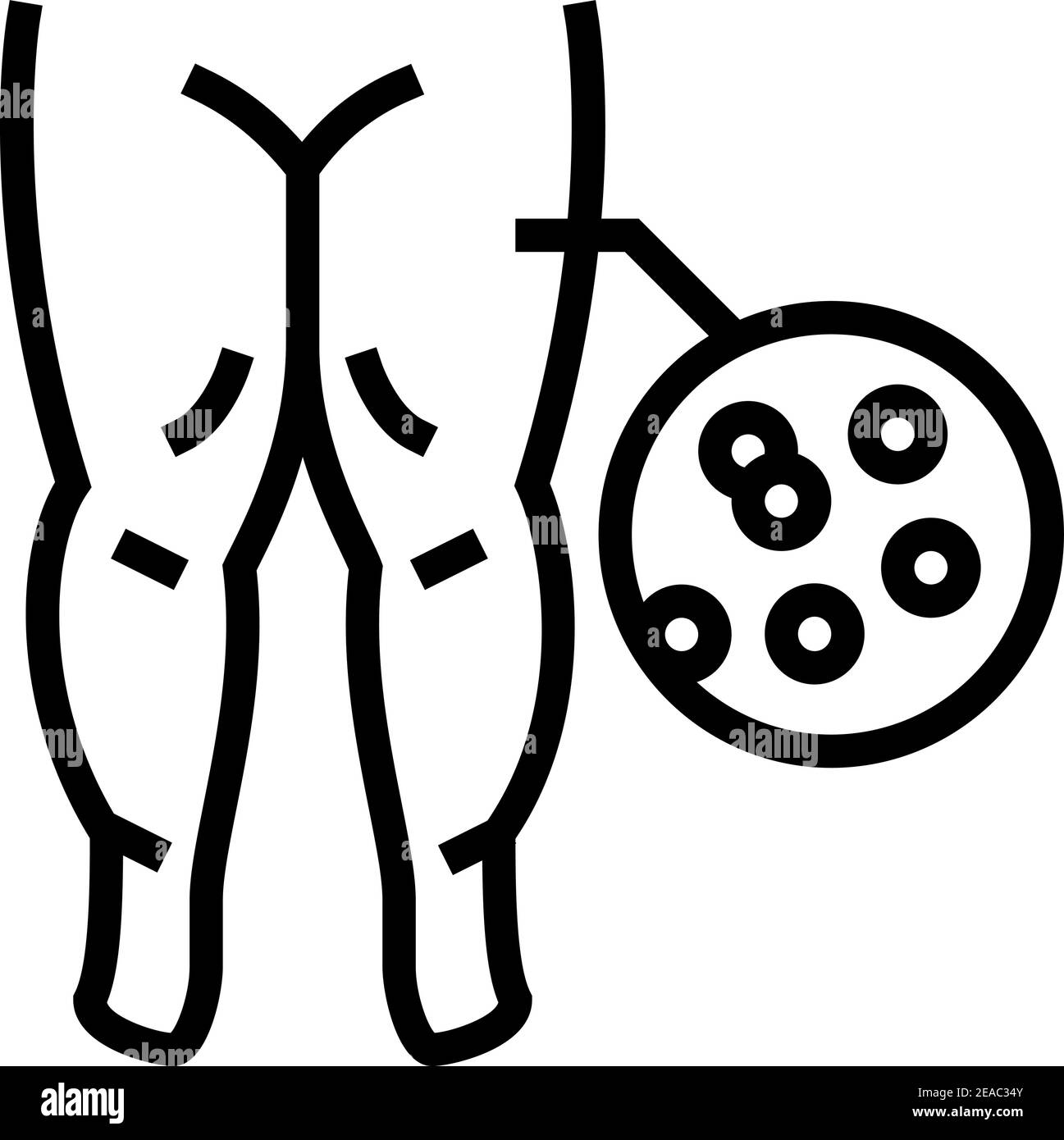 hypoproteinemic edema line icon vector illustration Stock Vector Image ...