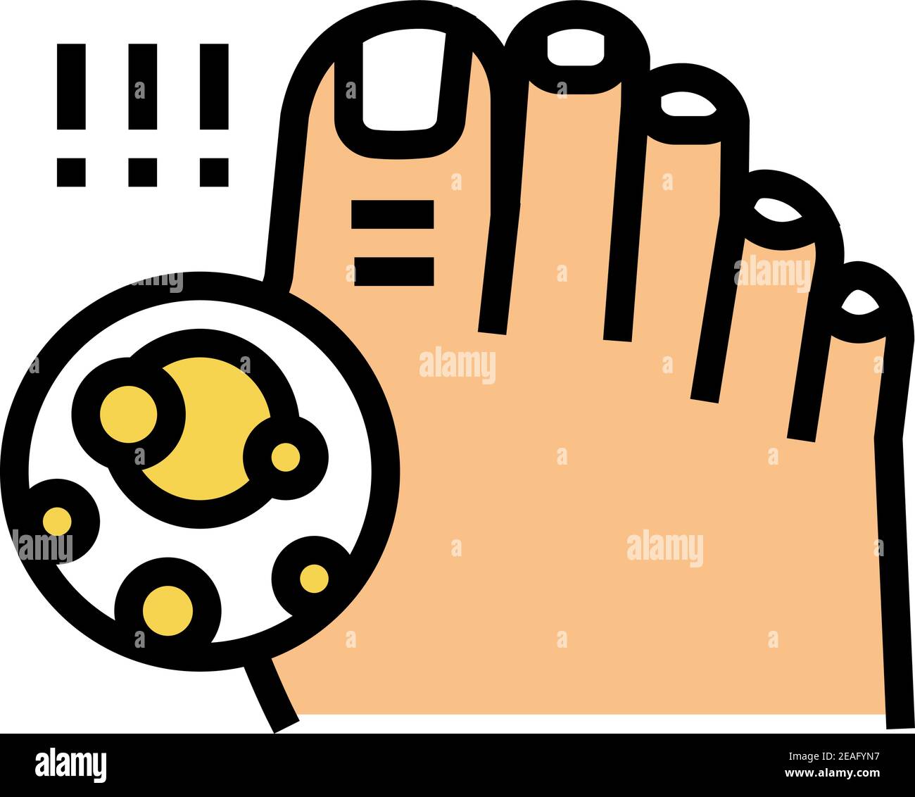 uric acid crystals gout color icon vector illustration Stock Vector ...