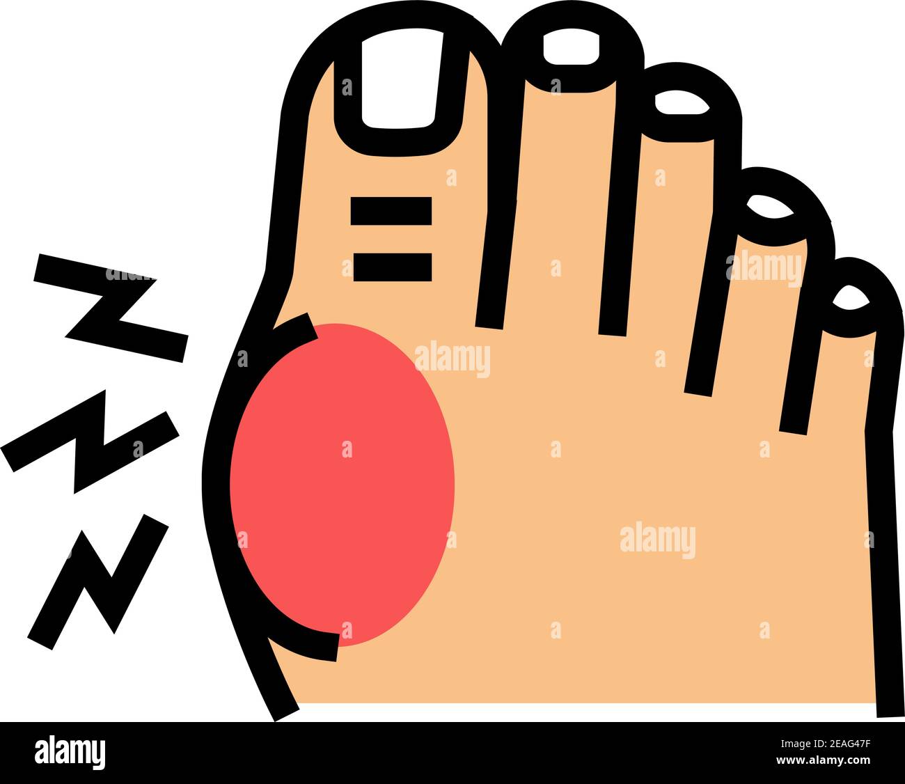pain in big toe color icon vector illustration Stock Vector Image & Art ...