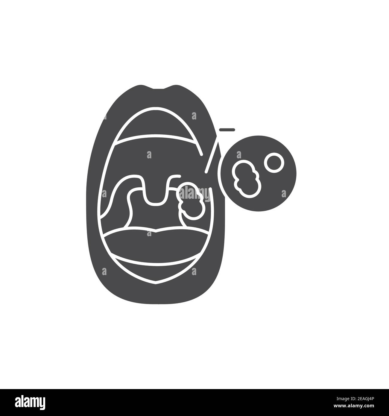 Adenoids vector vectors Stock Vector Images - Alamy