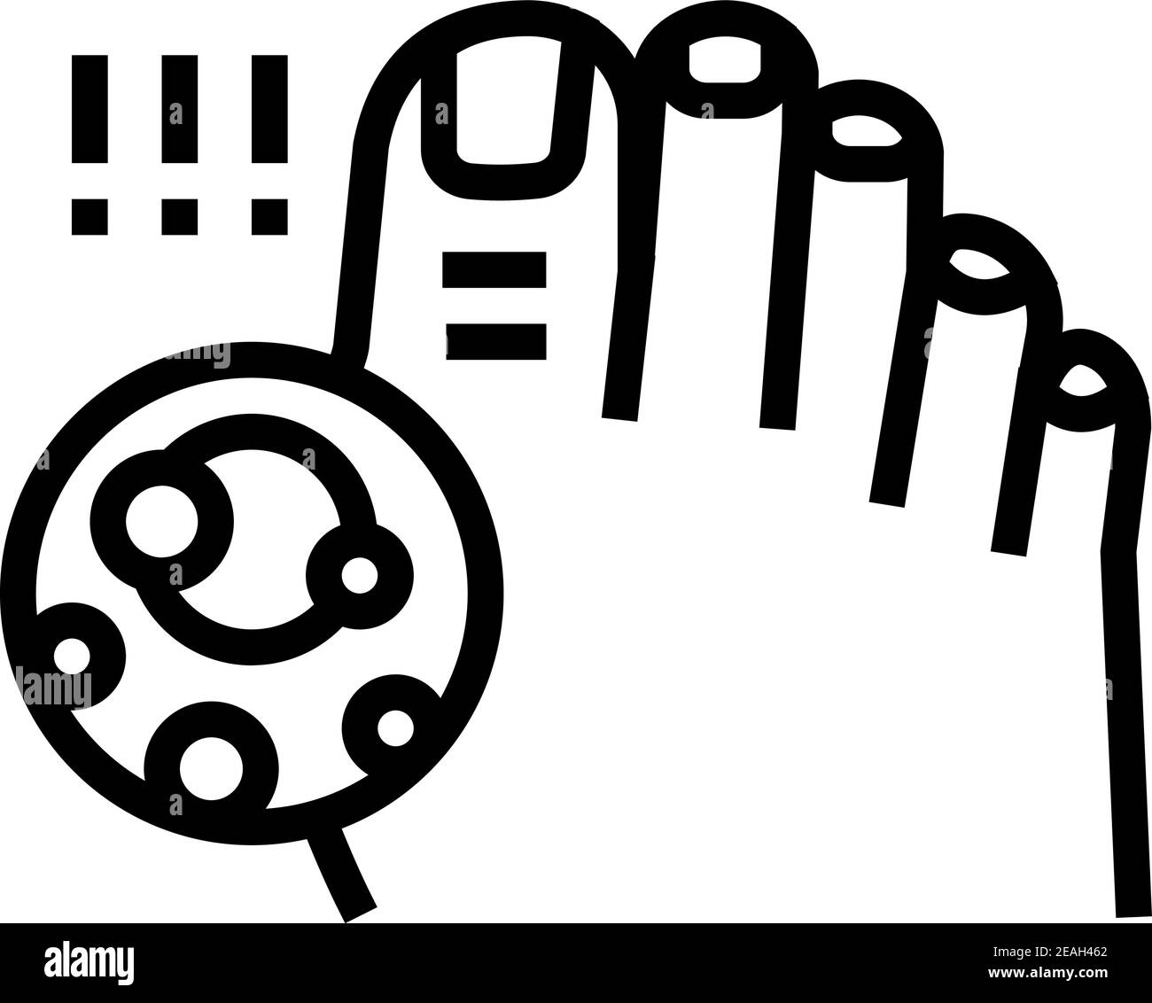 Uric acid crystals hi-res stock photography and images - Alamy