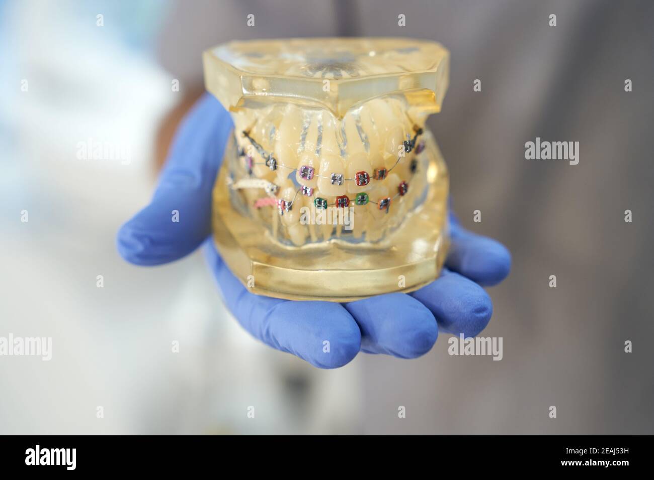 Dental doctor demonstrating teeth replica with braces on it Stock Photo ...