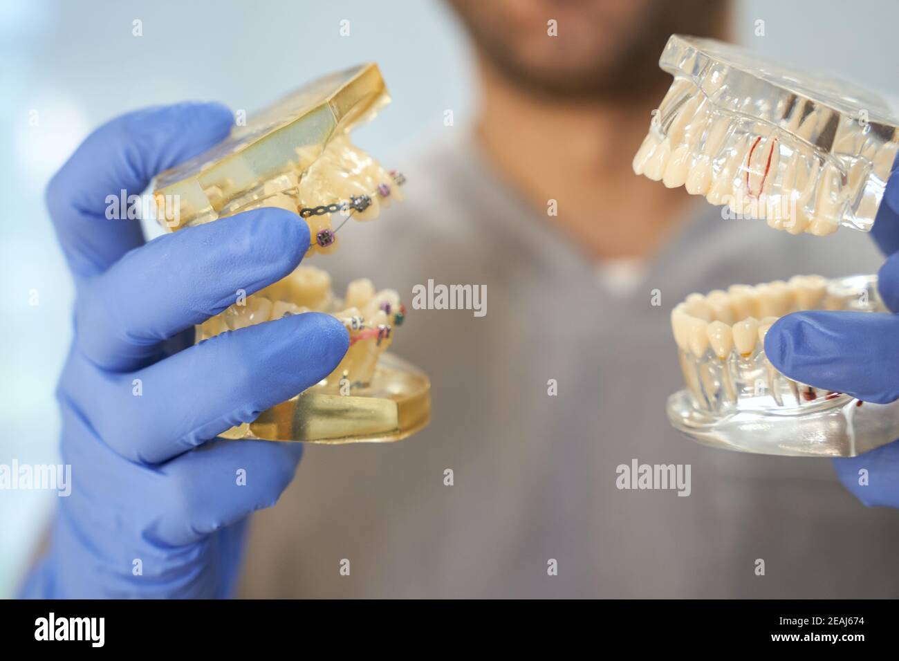 Dentist in gloves demonstrating two teeth replicas Stock Photo - Alamy