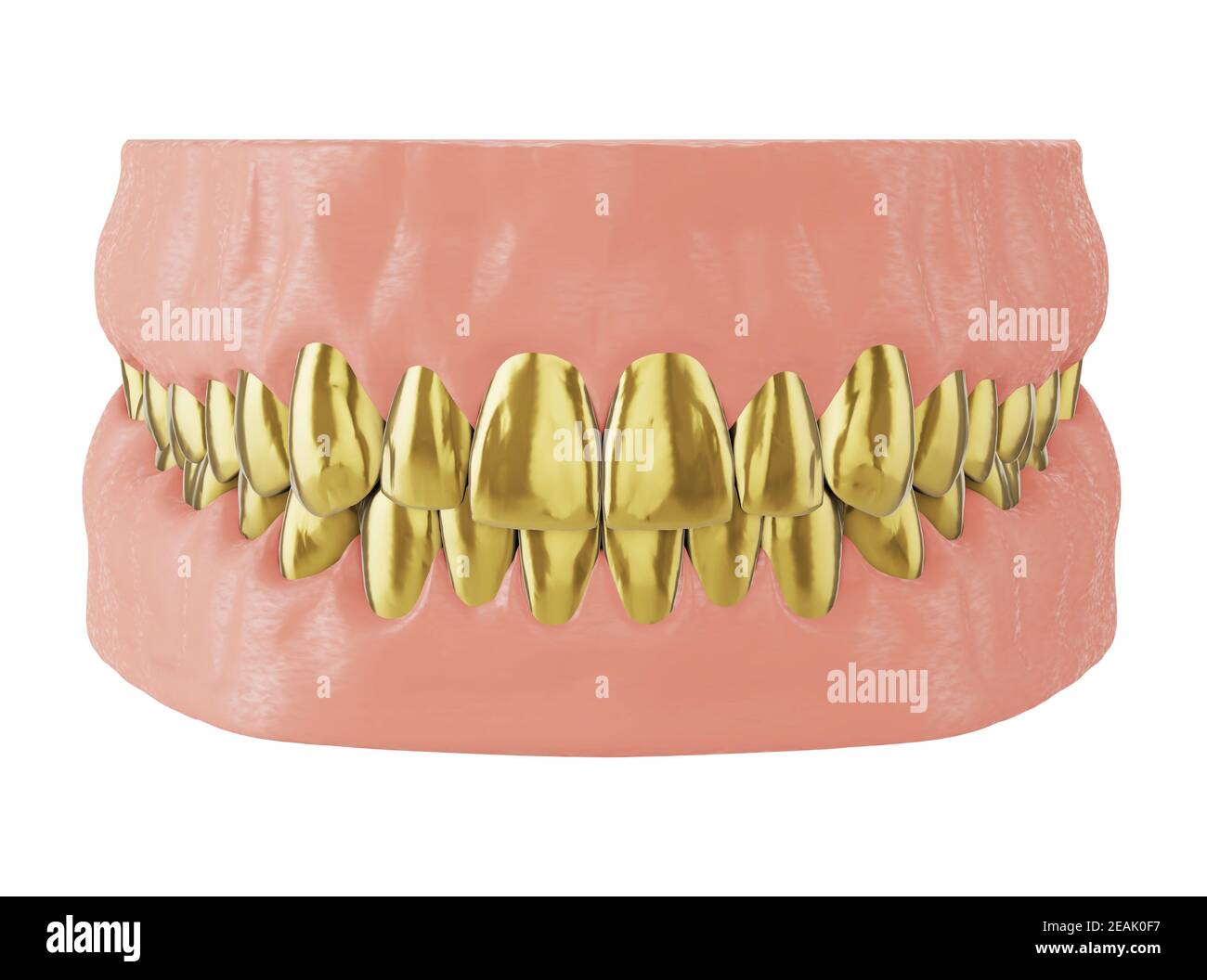 metal golden teeth in the jaw, golden crown of a teeth, 3d render Stock ...