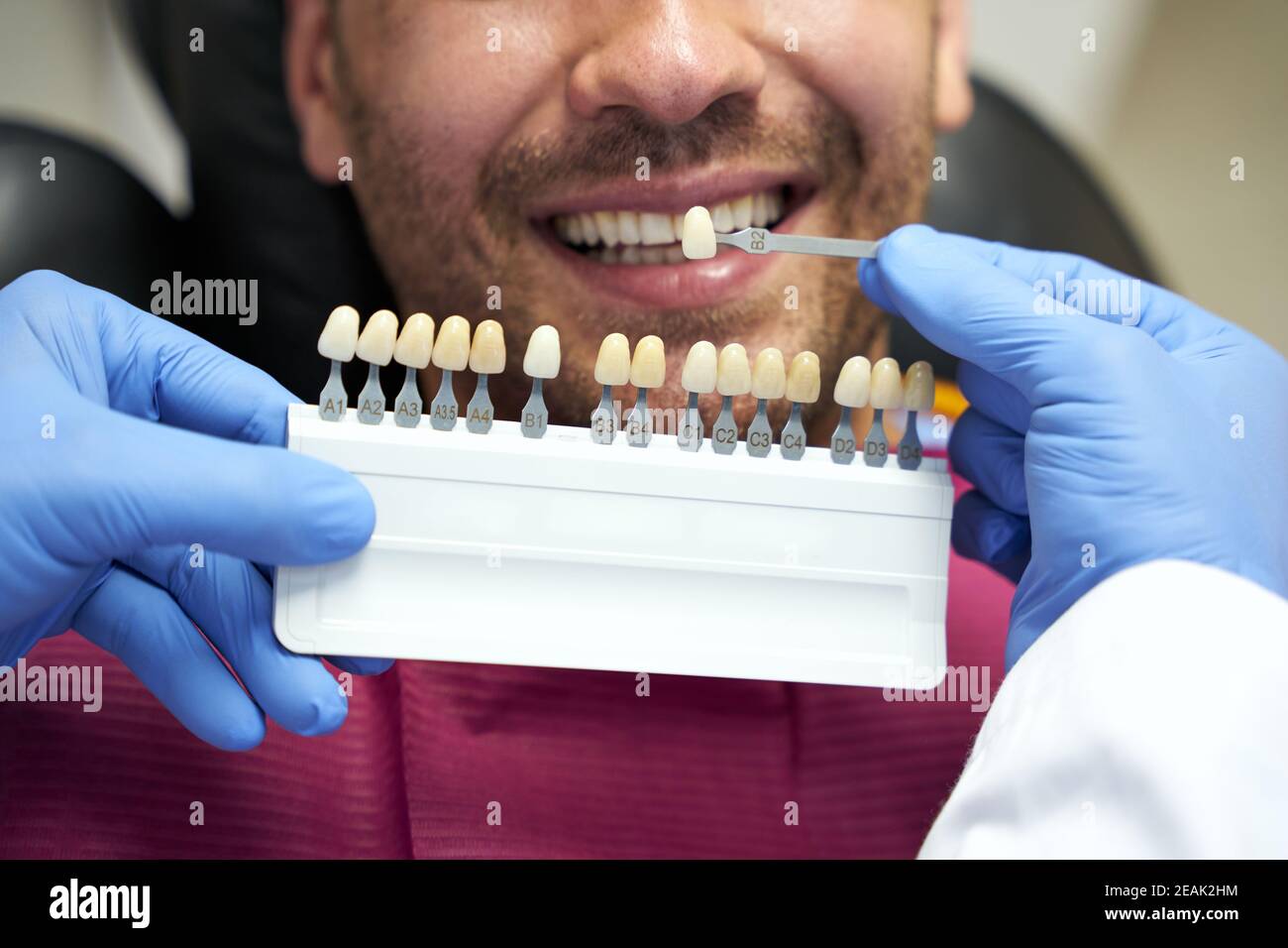 Dentist patient showing teeth to doctor with enamel samples Stock Photo ...