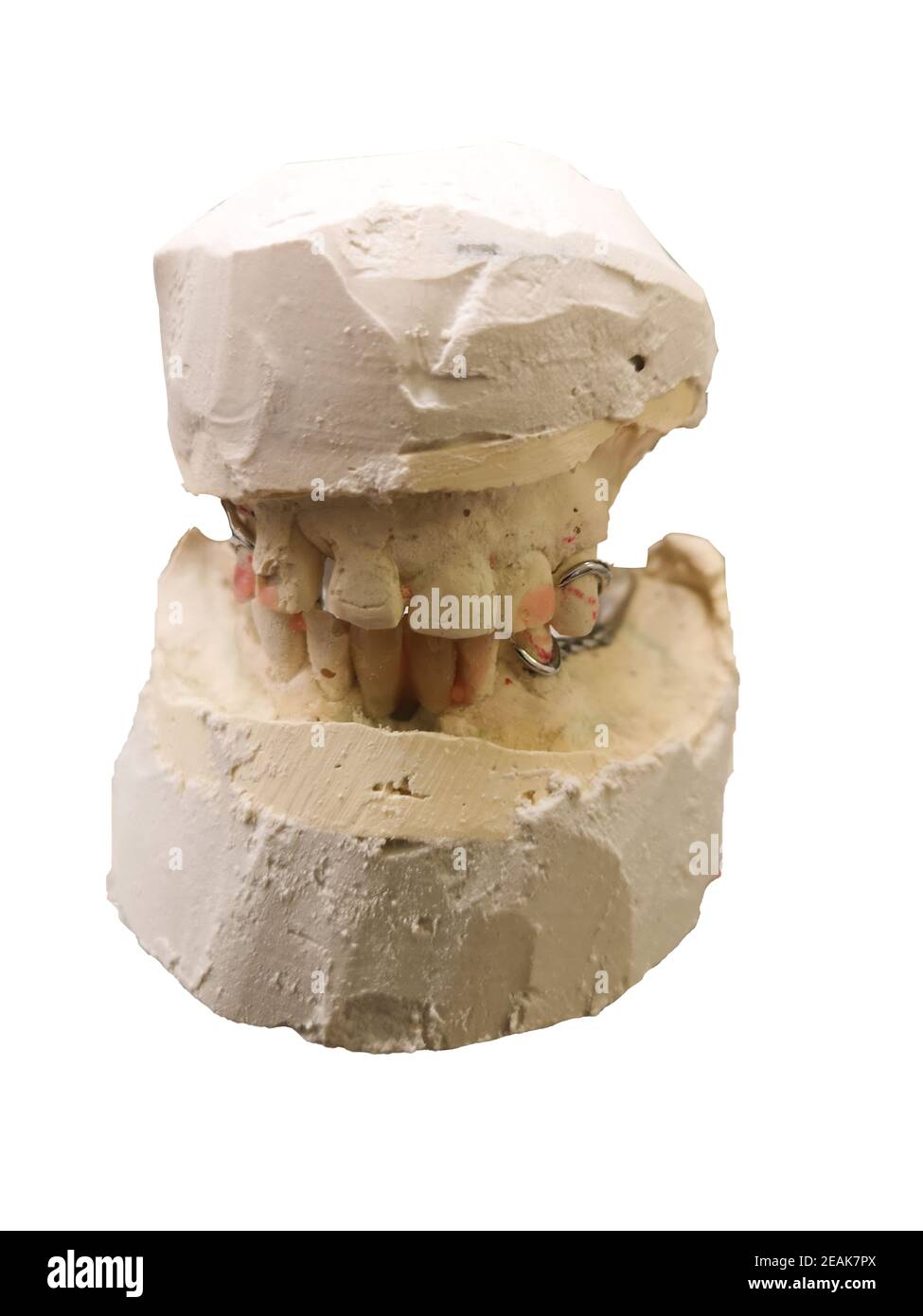 plaster footprint cast denture Stock Photo - Alamy