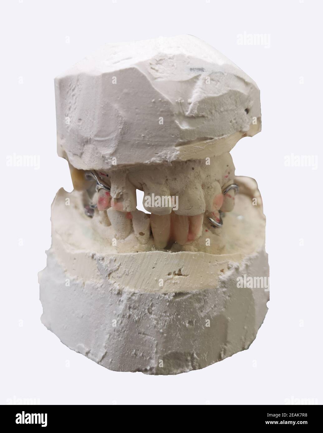 plaster footprint cast denture Stock Photo - Alamy