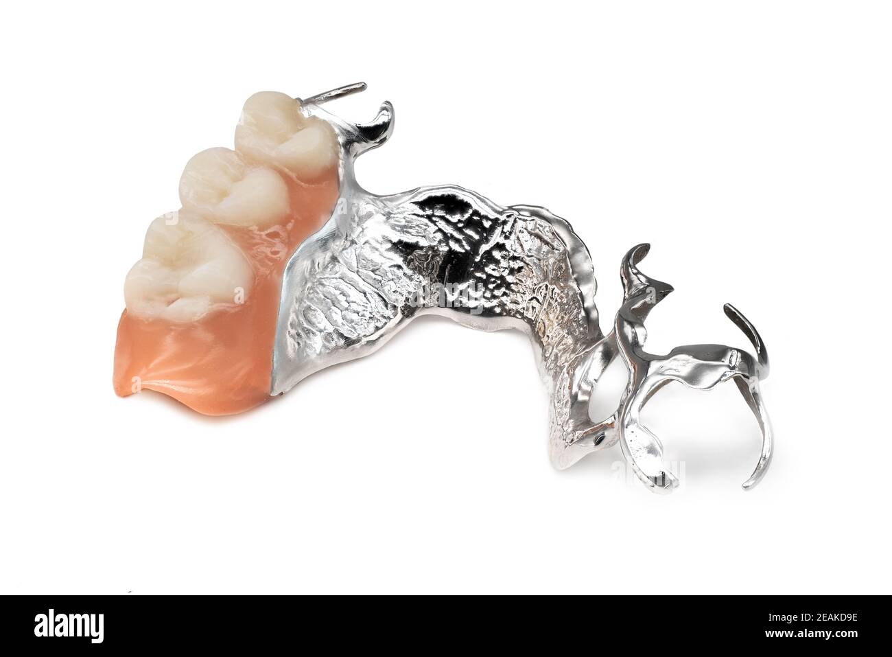 Removable Partial Denture Stock Photo - Alamy