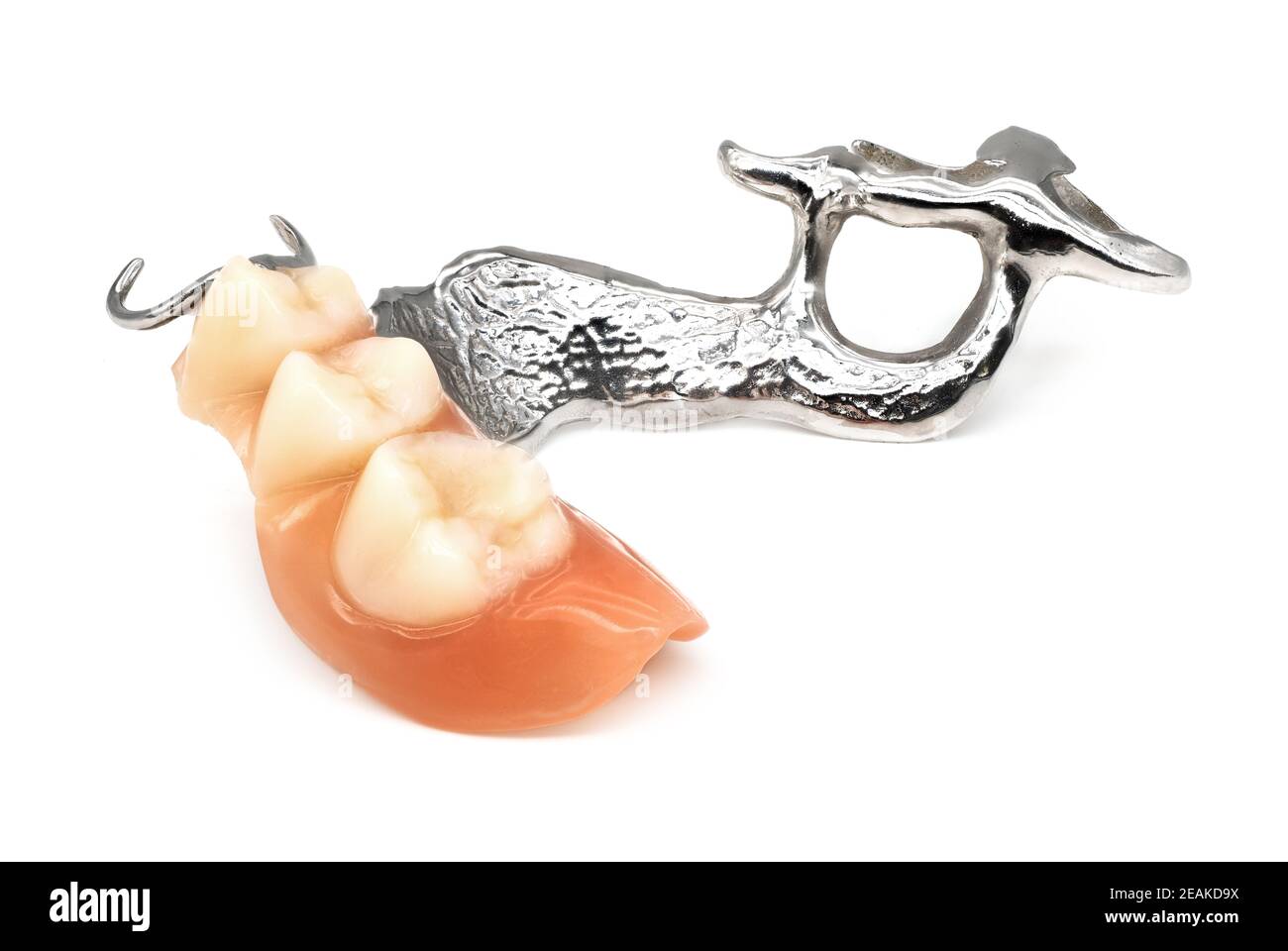 Removable Partial Denture Stock Photo - Alamy