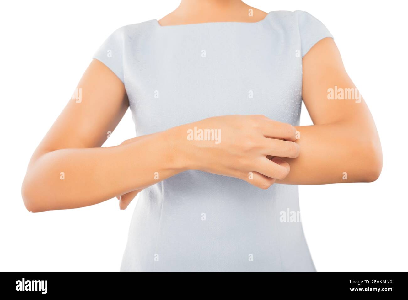Itchy skin rash hi-res stock photography and images - Alamy