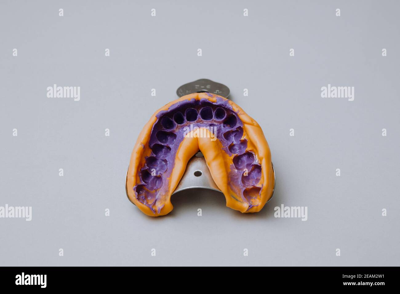 The dental impression is filled with a patch, creating a prosthetic ...