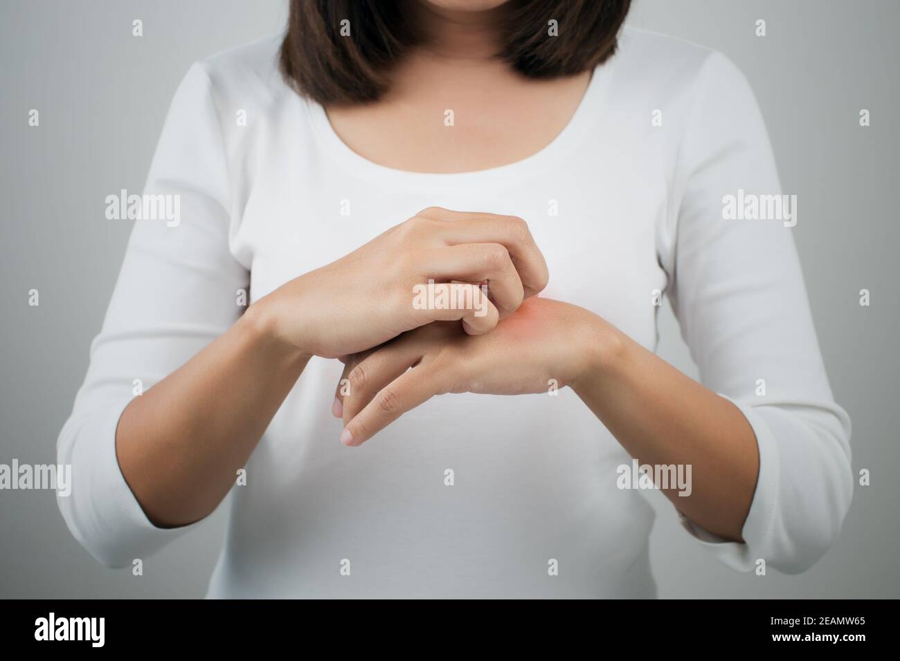 Itch scratch hi-res stock photography and images - Alamy