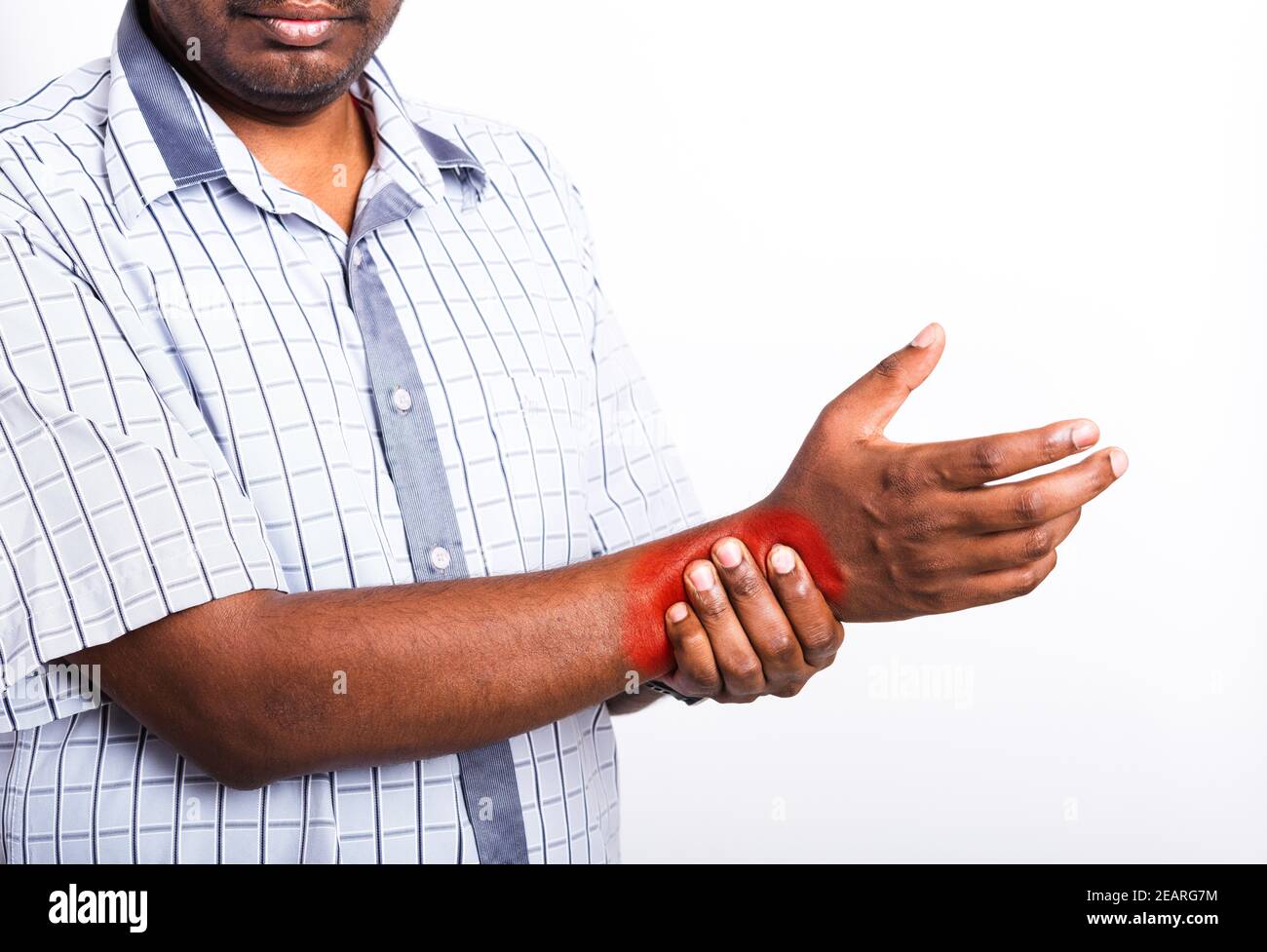 Hand injury hi-res stock photography and images - Alamy