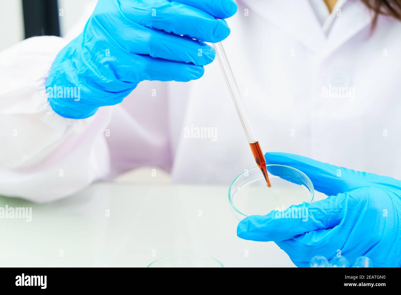 Scientist analyzing a blood sample on tray in laboratory Stock Photo ...