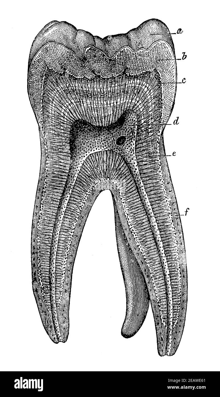 Longitudinal section through a human tooth. Illustration of the 19th ...