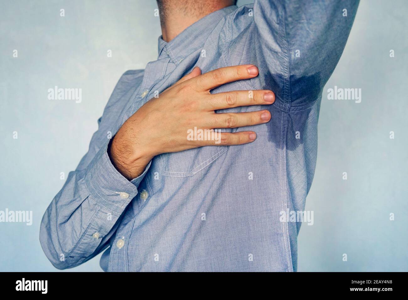 Man with hyperhidrosis sweating very badly under armpit in blue shirt ...
