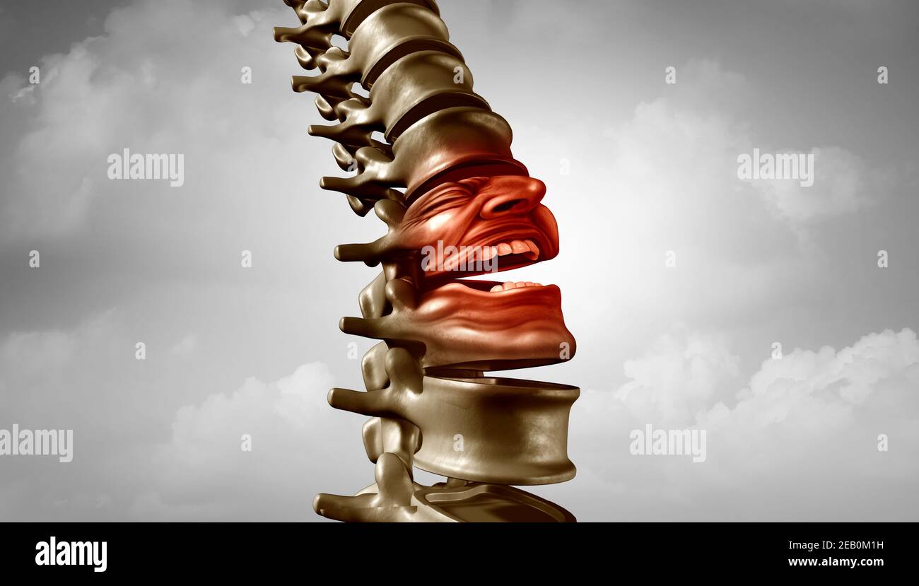 Broken spine hi-res stock photography and images - Alamy