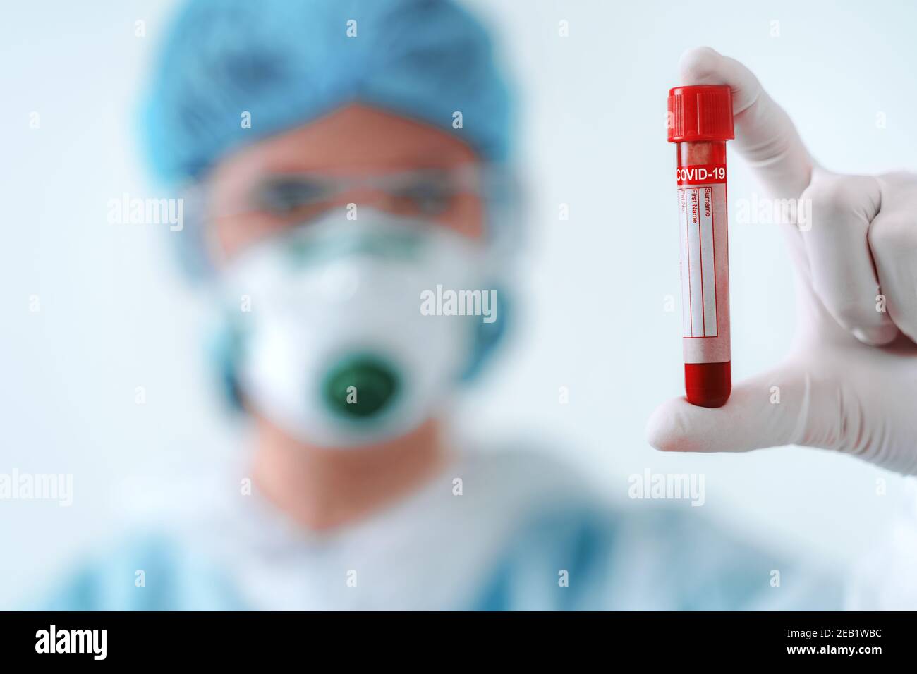 Blood test result hi-res stock photography and images - Alamy