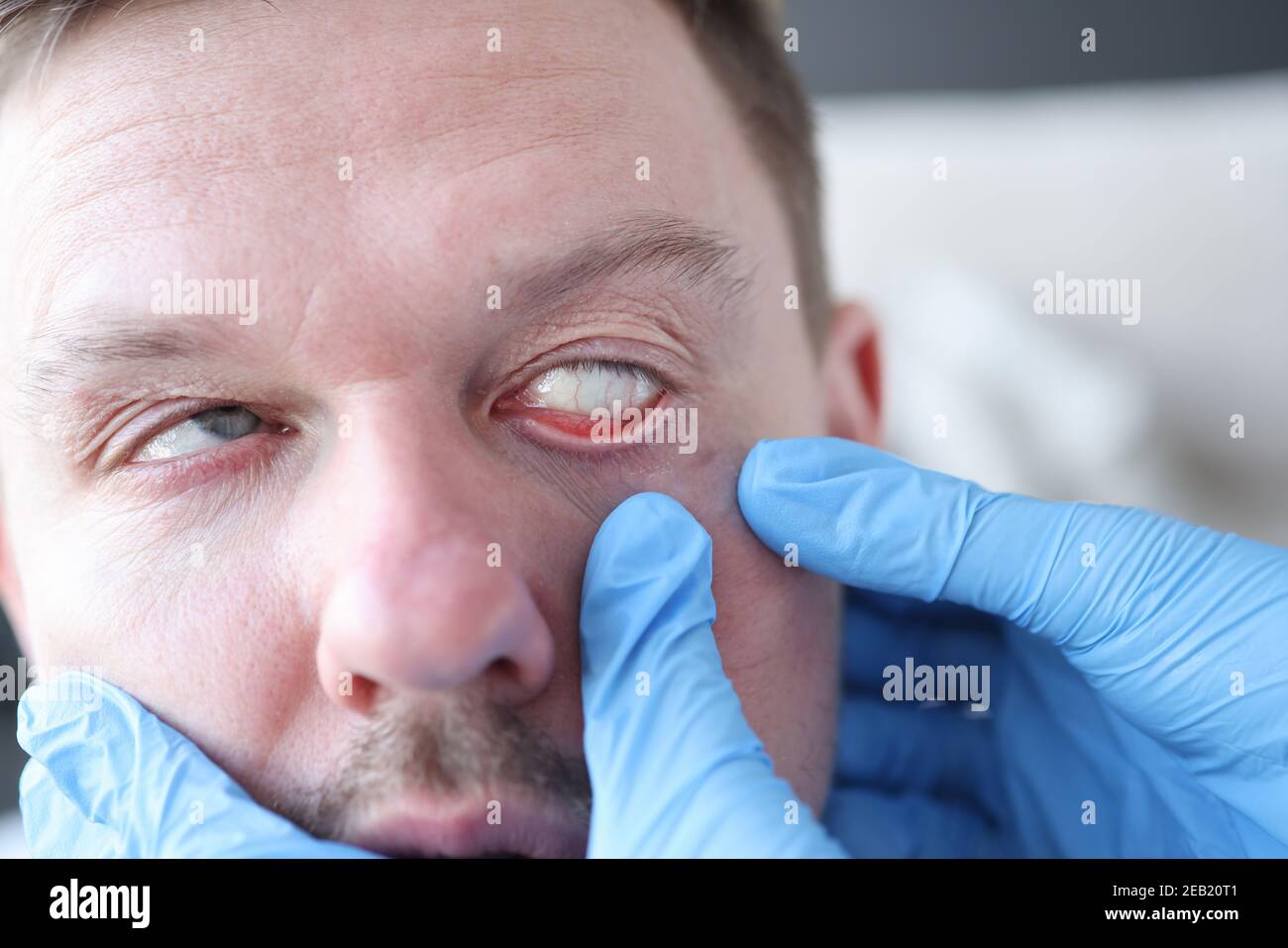 An ophthalmologist examines the patient's eye closeup Stock Photo - Alamy