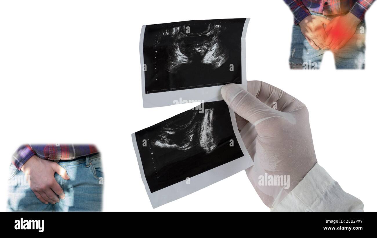 Male prostate, pain in the urogenital canal, the doctor analyzes the ...