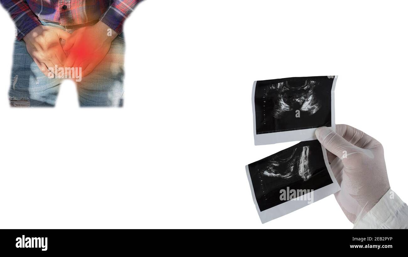 Pain in the prostate in men highlighted in red, ultrasound of the ...