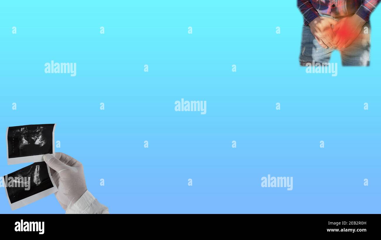 Ultrasound of the prostate in the hands of the surgeon, pain in the ...