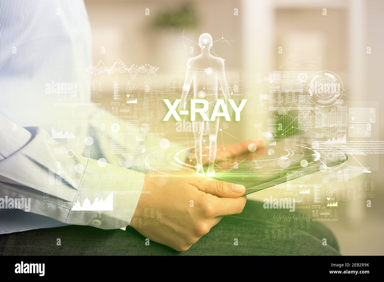 Electronic medical record with X-RAY inscription, Medical technology ...