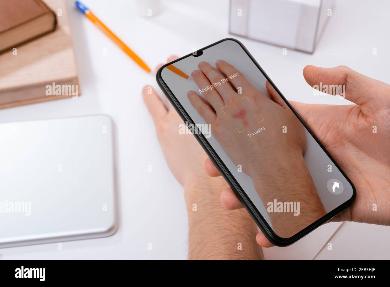 Man using a phone app to recognize skin problems on his hand Stock ...