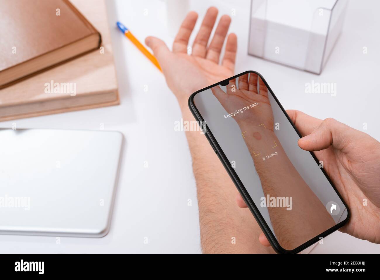Man using a phone app to identify a red spot on his hand Stock Photo ...