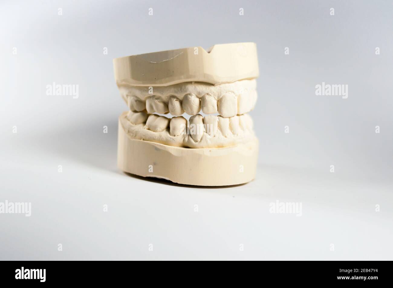 Complete dental impression with lower and upper jaw on a light ...