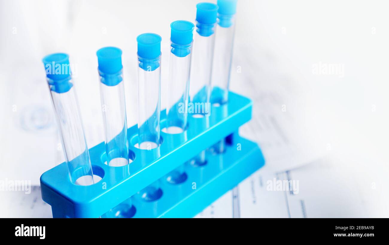 Test tubes on a blue stand against a background of blurred sheets with ...