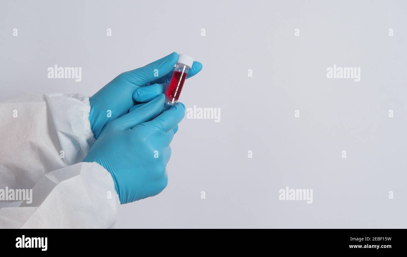 Blood tube. Covid 19 Test. doctor hand holding a blood sample tube for ...