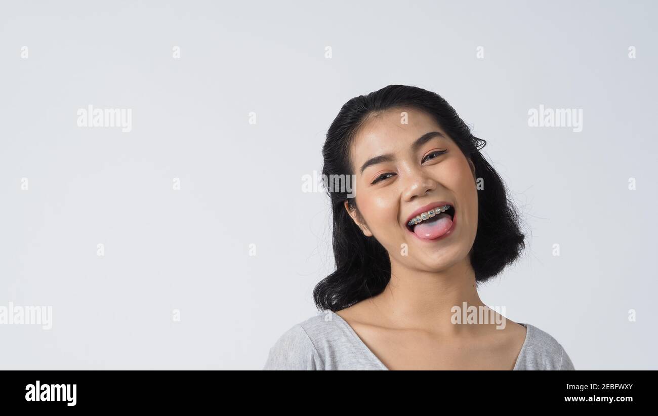 Oral Care. Dental brace teenager girl smile and looking to camera ...
