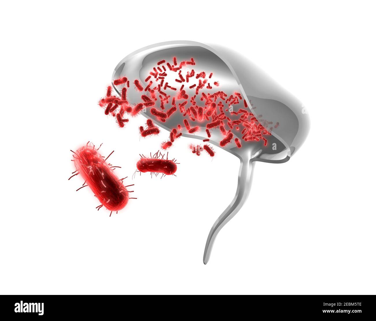 Bacterial cystitis, illustration Stock Photo - Alamy