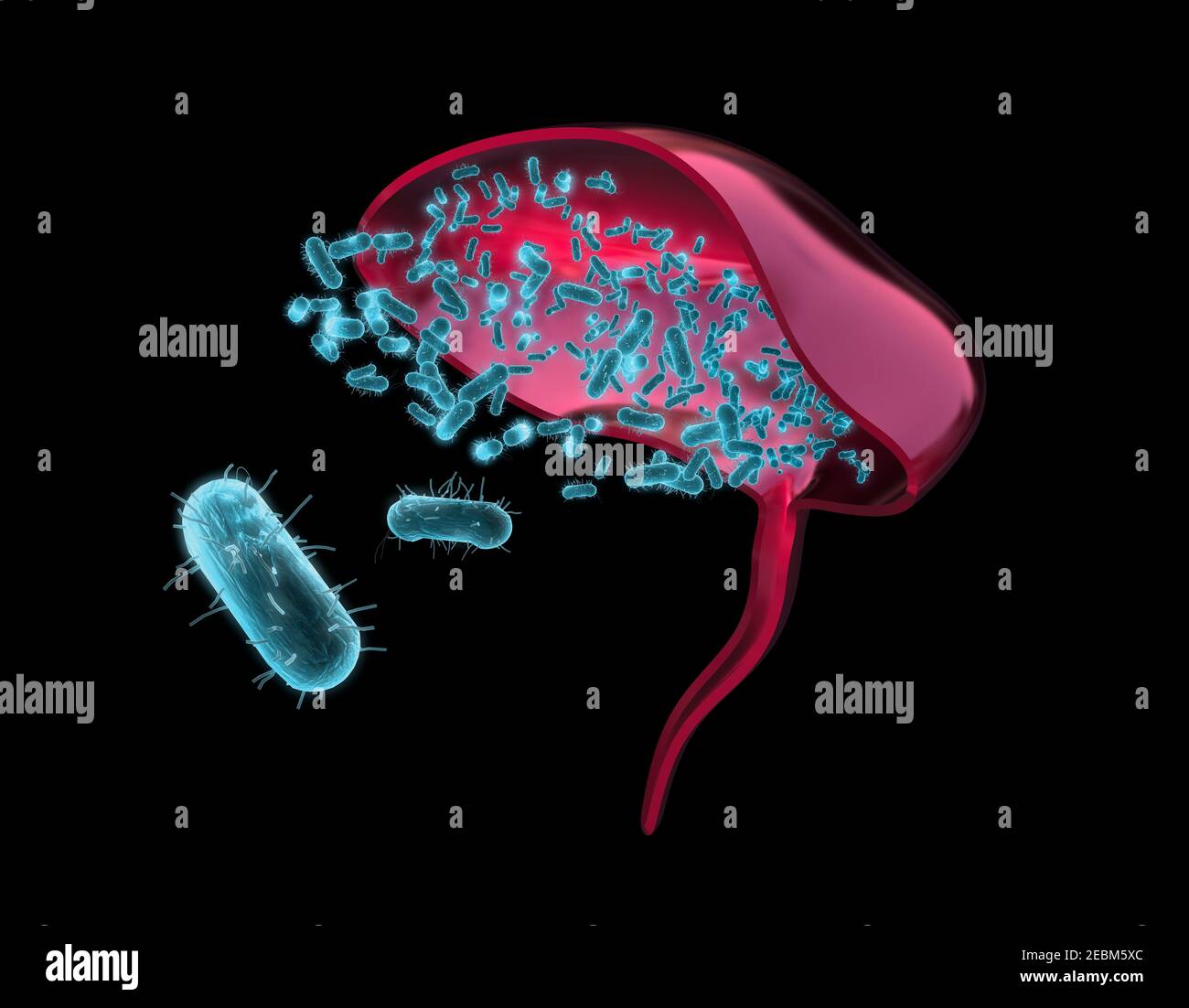 Bacterial cystitis, illustration Stock Photo - Alamy