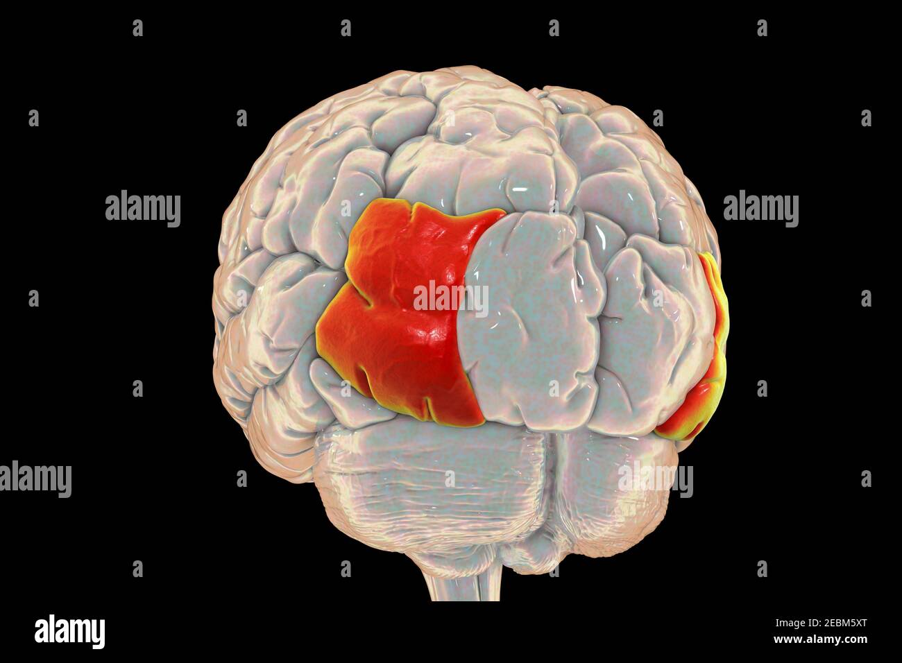 Occipital lobe hi-res stock photography and images - Alamy