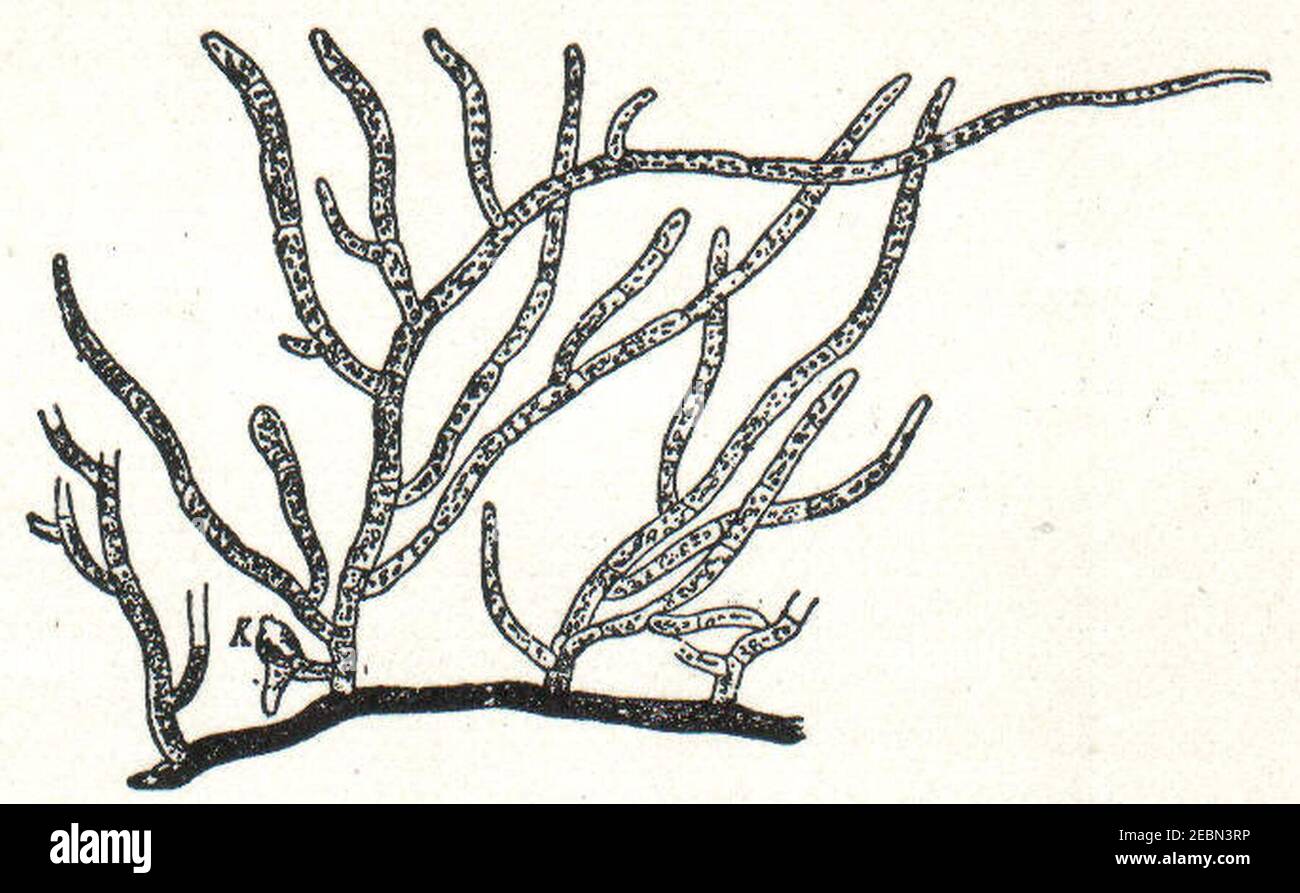 Moss Protonema Labeled