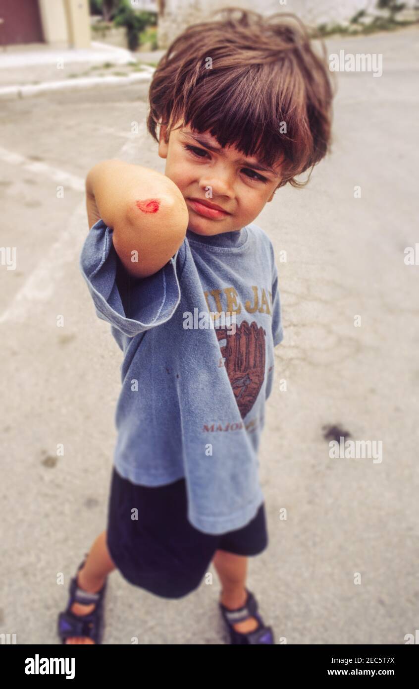 A small boy apprehensively and in some pain showing his wound after ...