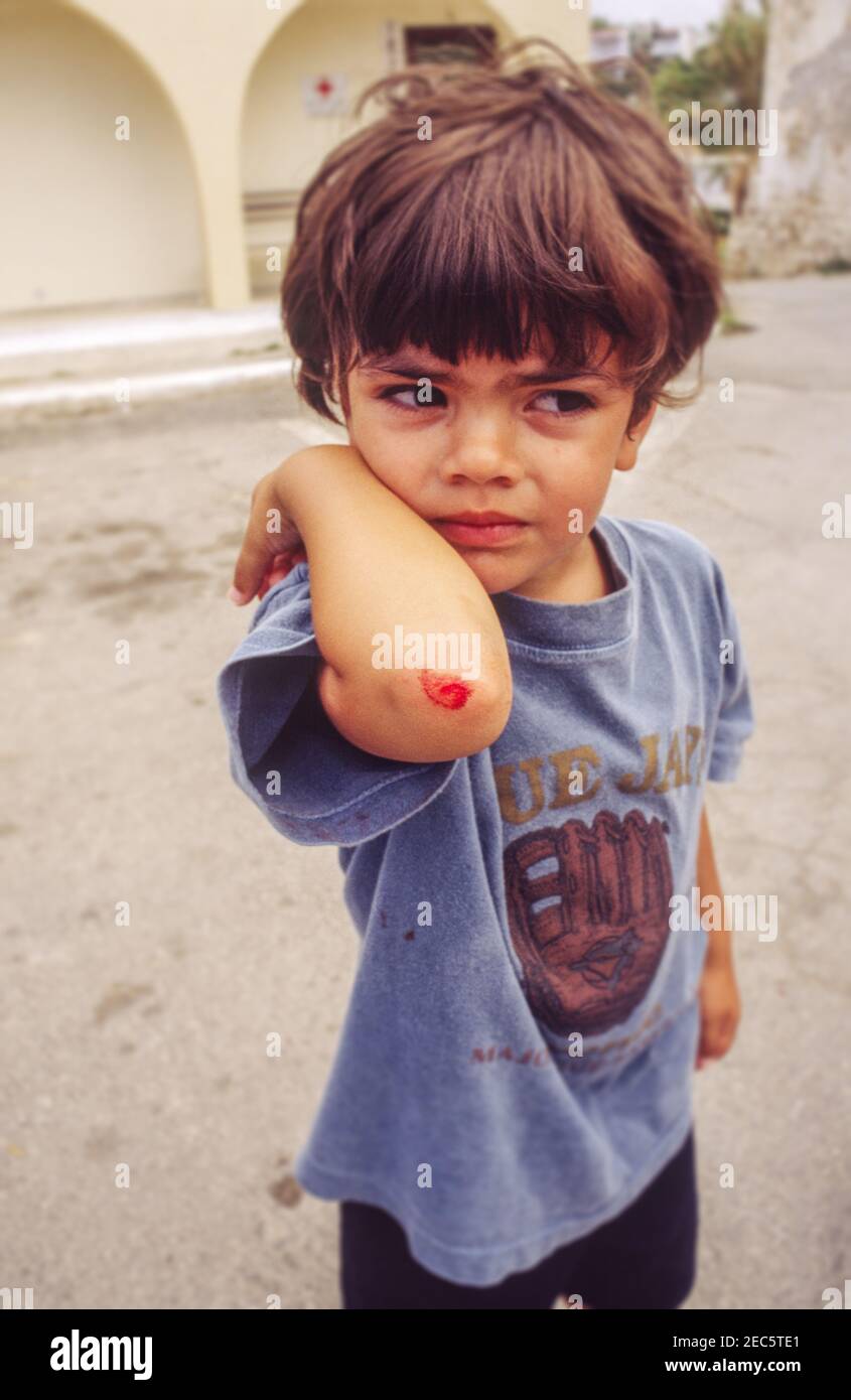 A small boy apprehensively and in some pain showing his wound after ...